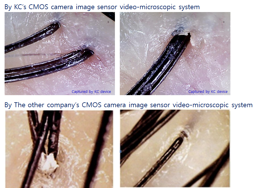 Why KC? – KC Technology